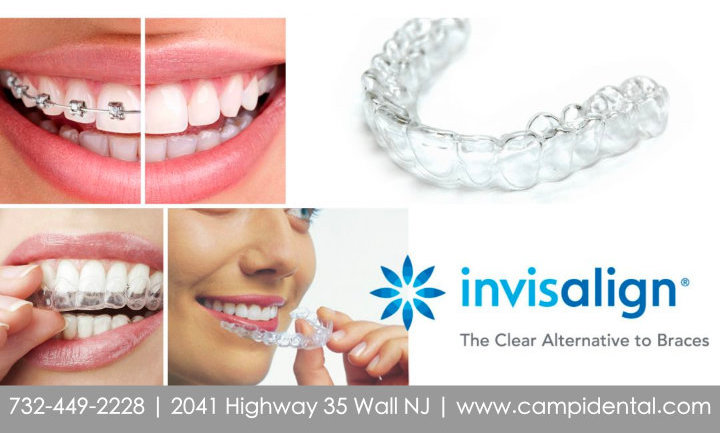 October is Invisalign Month at Campi Dental